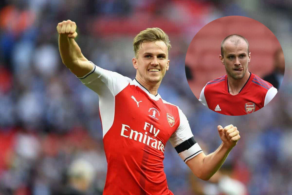 Rob Holding's Remarkable Hair Transplant Transformation - Haista Clinic